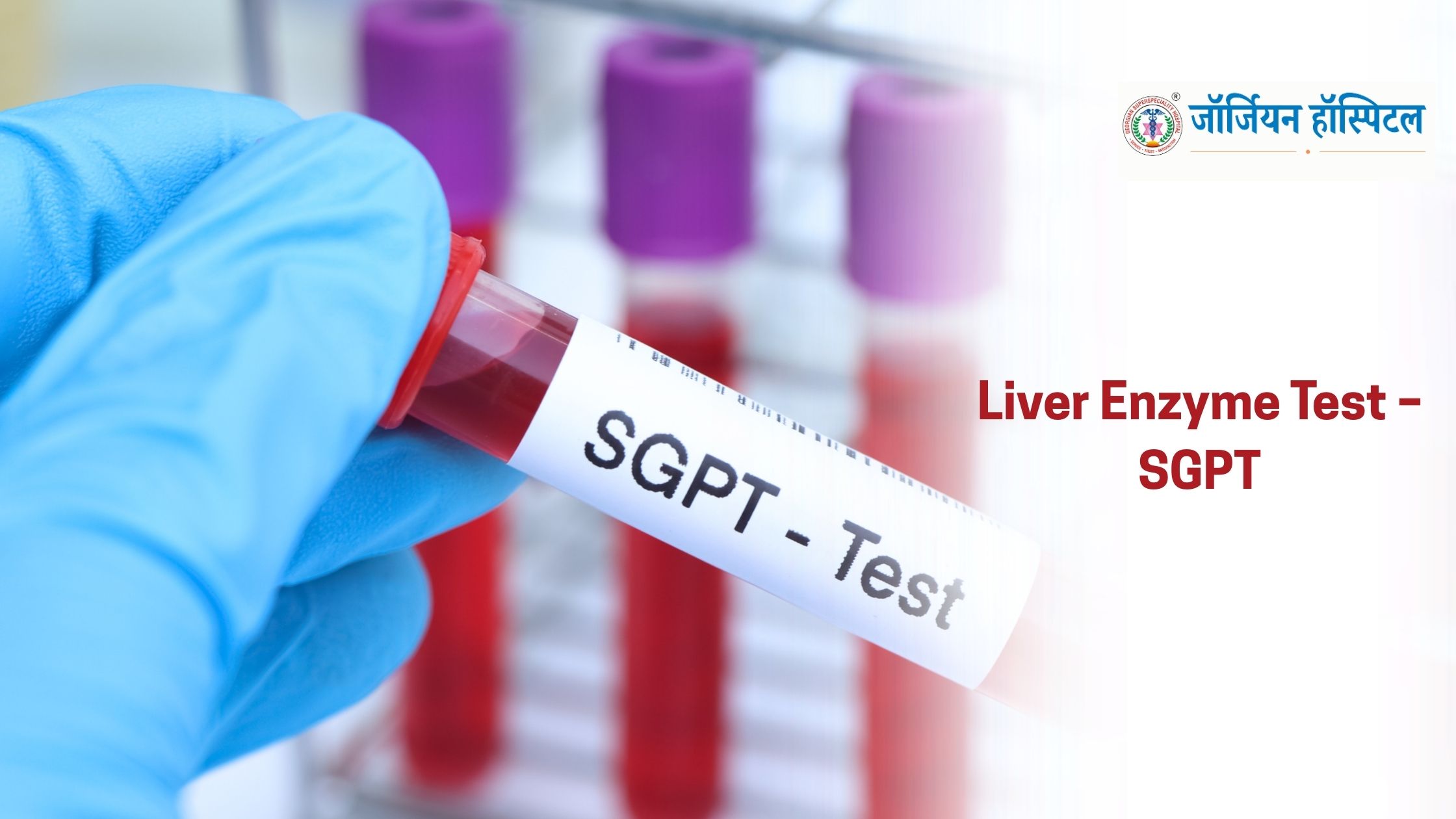 SGPT Blood Test in Varanasi – 7991508183